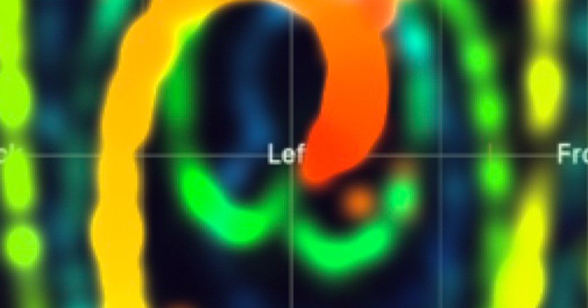 Spherical Sound: from Ambisonics to Atmos | NMC